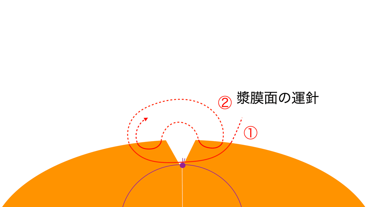 子宮筋腫核出術への私のこだわり7 - 漿膜の縫合 -｜ラパロスコピストの夢2025
