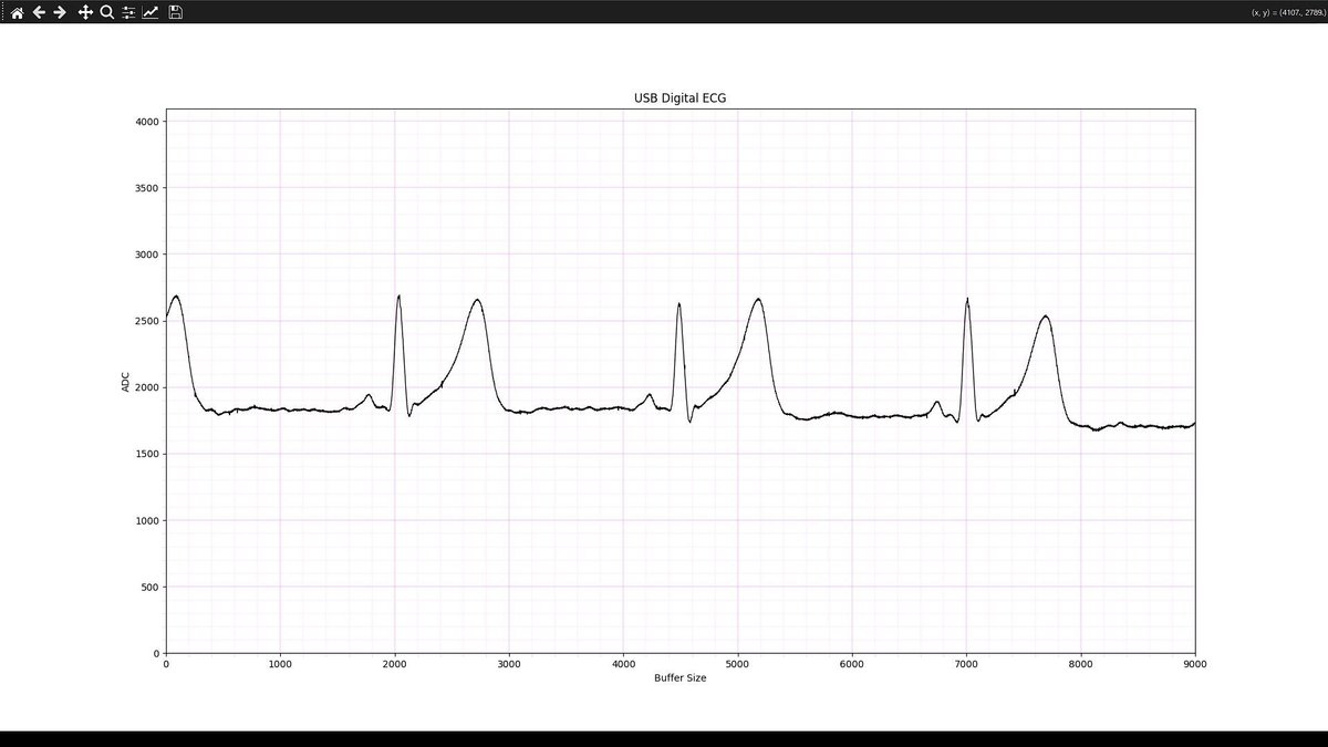 心電計のCMRRは測定結果にどれほどの影響を及ぼすのか｜namamugi