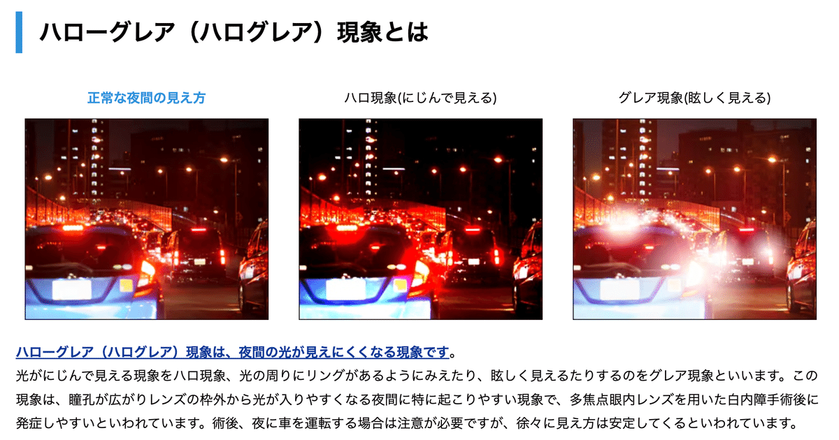ICL手術を受けた経緯、そして半年経過した感想｜カブト