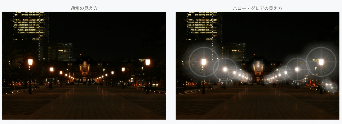 ICL手術を受けた経緯、そして半年経過した感想｜カブト