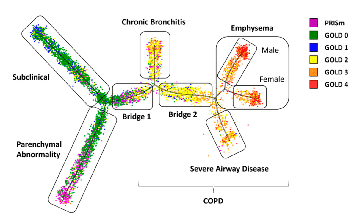慢性閉塞性肺疾患(COPD)の表現型の時間的探索：COPDGeneとSPIROMICSコホートからの知見｜限界内科助教