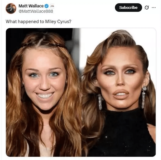 2025 年5月時点のMiley Cyrus氏のビフォー／アフターは、フェイク画像を使って「何が起こったのか」を問いかけています。｜JosephYoiko