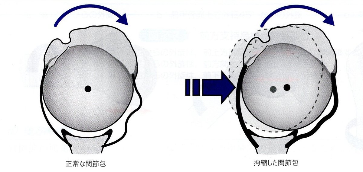 Obligate translationとは？│理学療法｜リハログの森