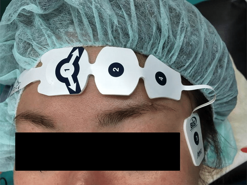 全身麻酔って？どんな流れ？｜nao