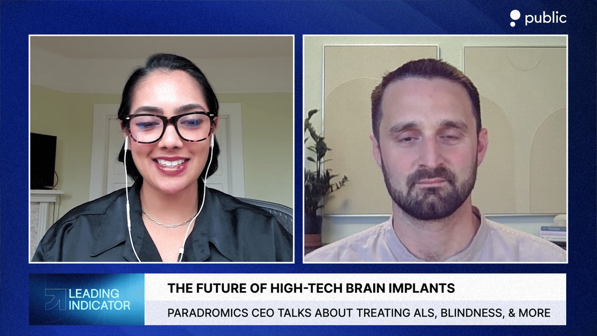 年内商用化を目指す「Paradromics」のブレイン・コンピュータ・インタフェース｜だうじょん