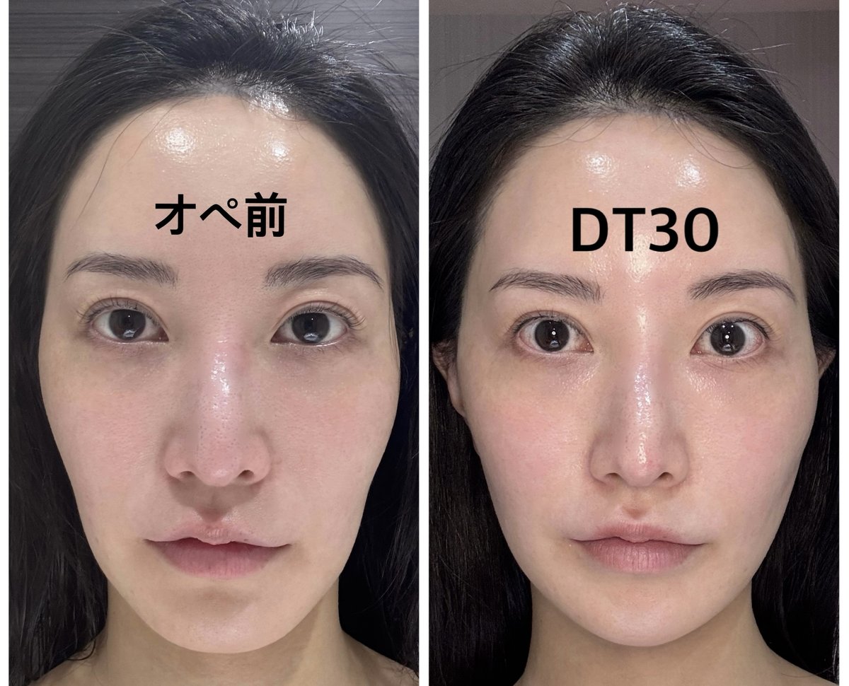 「ダダ嫁、再構築中」vol.15｜DT17〜30総まとめ編〜神経痛、爆誕。〜｜ダダ嫁