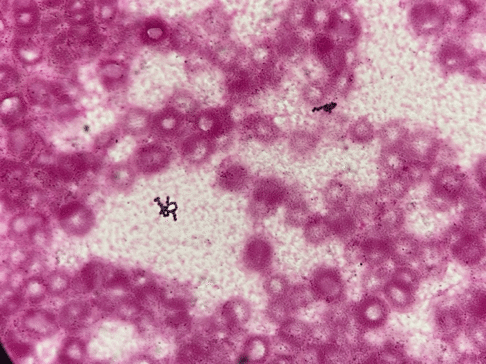 Corynebacterium striatum｜kohei hasegawa