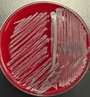 Corynebacterium striatum｜kohei hasegawa