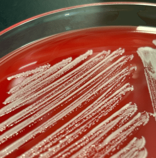 Corynebacterium striatum｜kohei hasegawa