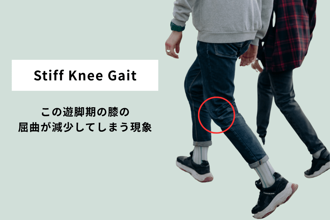 「太ももの張り」を可視化できていますか？~Stiff Knee Gaitの視点とDuncan–Elyテストの臨床的意義~｜渡辺しんご ...