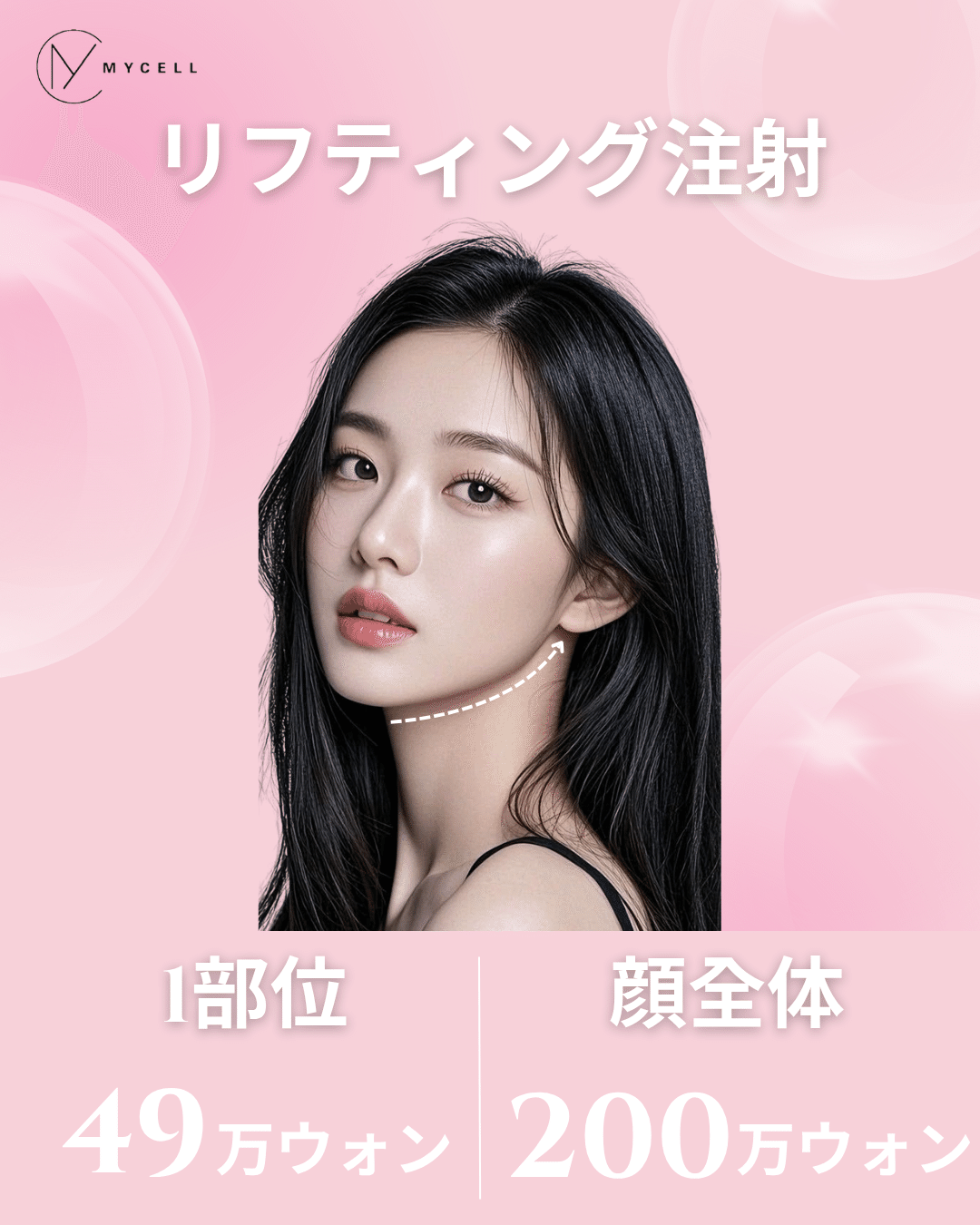 【ダウンタイム最小】切らずに叶える、自然なリフトアップ注射のご紹介｜Mycell Clinic｜マイセルクリニック｜江南整形外科｜韓国美容