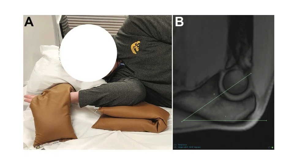 新しい肘の評価法「FEVER view MRI」は選手のパフォーマンスを予測できるか？｜キム・ヒョン