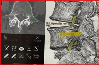 画像等手術支援認定診療放射線技師資格試験対策⑦｜ぎ資格