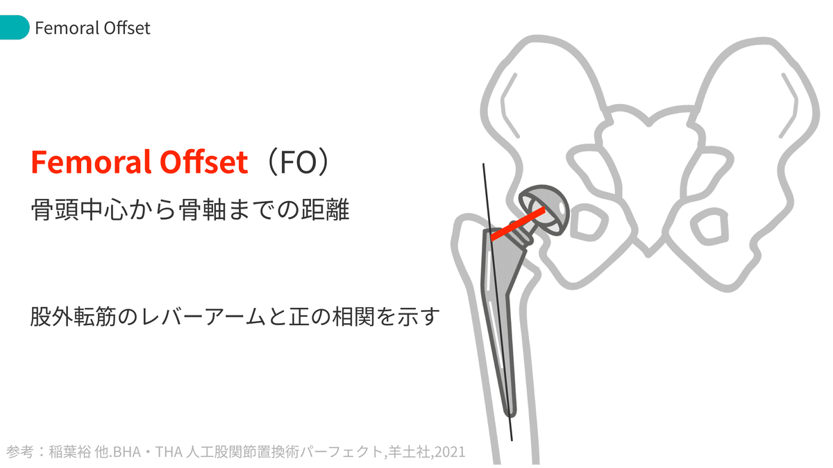 THAの"Offset"を徹底解説！－術後の評価と臨床思考プロセス－｜もやぞう@理学療法士