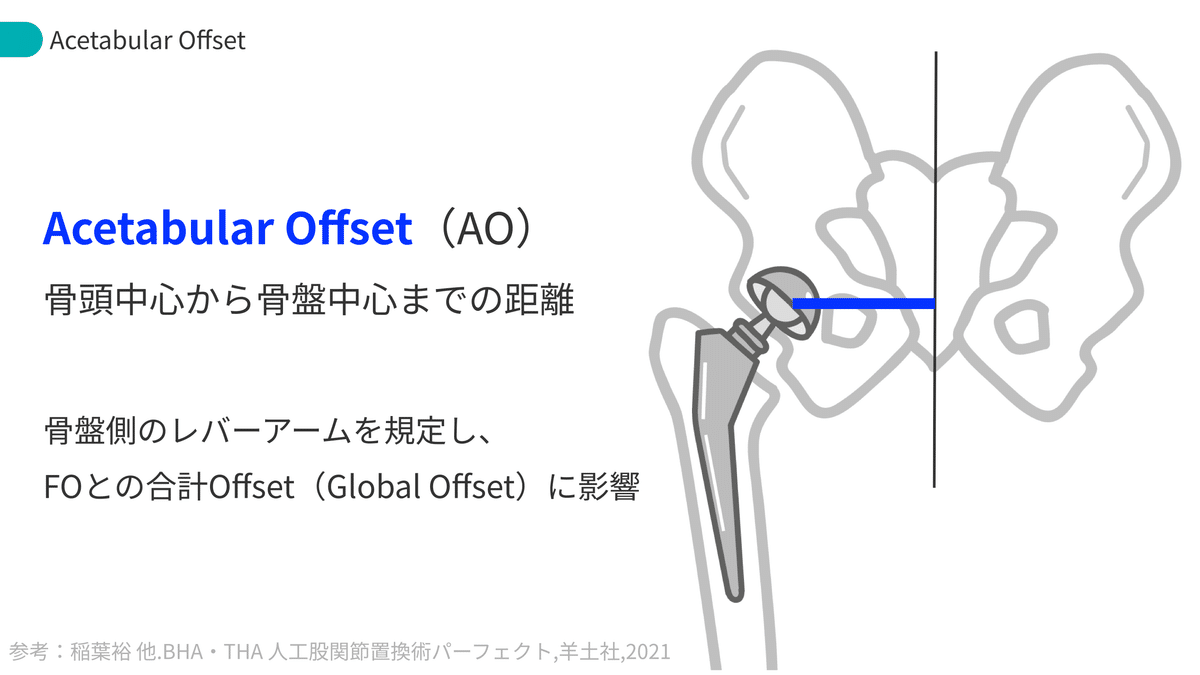 THAの"Offset"を徹底解説！－術後の評価と臨床思考プロセス－｜もやぞう@理学療法士
