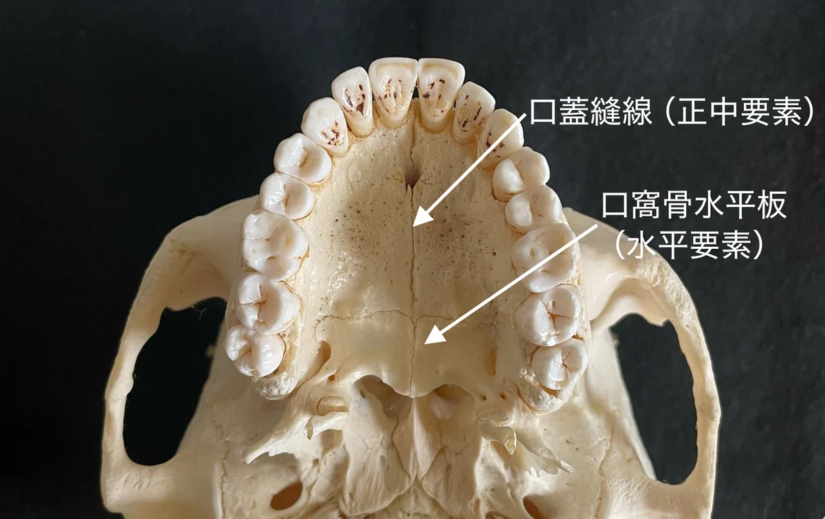 正中・切歯乳頭と口蓋雛壁の分析（上顎）｜hiro 1451