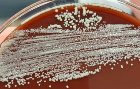 Cutibacterium avidum｜kohei hasegawa