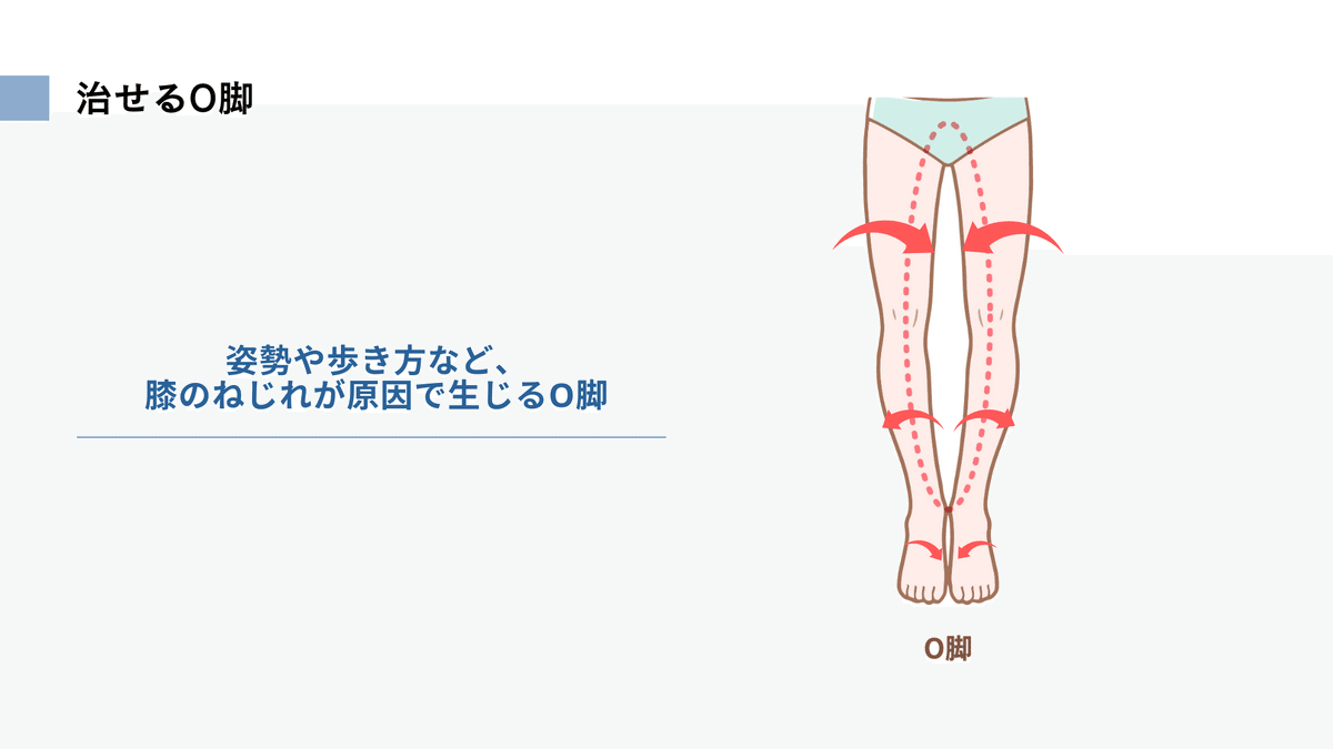 O脚はハムストリングスがカギ！解剖から読み解く脚のアライメントと改善エクササイズ｜藤元奏斗｜やさしく学べる解剖の知識
