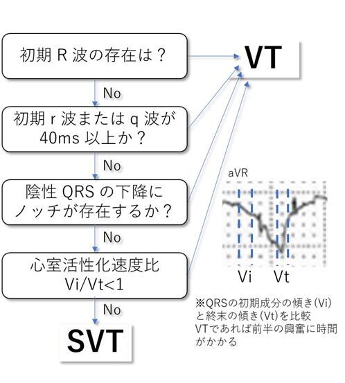 心室頻拍（Ventricular Tachycardia：VT）｜心電’s 合格塾（藤澤友輝）