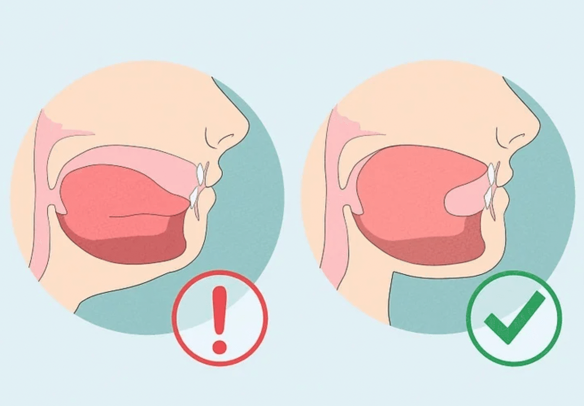 『歯列矯正とインプラント』 −外から整える行為の功罪−｜續池均（kintsuzuike）@MTR Method Lab®︎