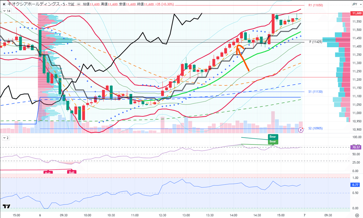 2026/1/6 日本株｜ponpoundpain