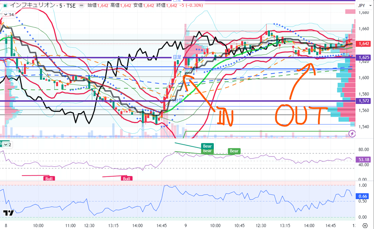 2026/1/9 日本株｜ponpoundpain