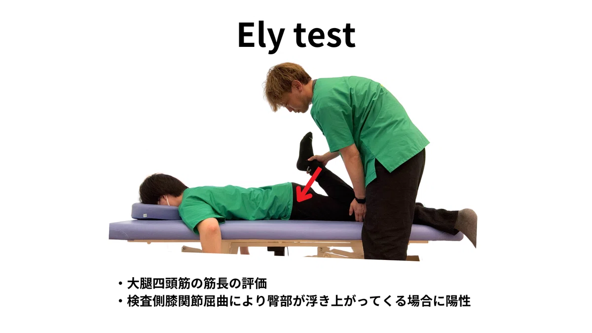 「陽性だから大腿四頭筋が硬い」で終わってない？Ely testの誤解と真の解釈｜松井 洸@膝初心者から膝の専門家へ