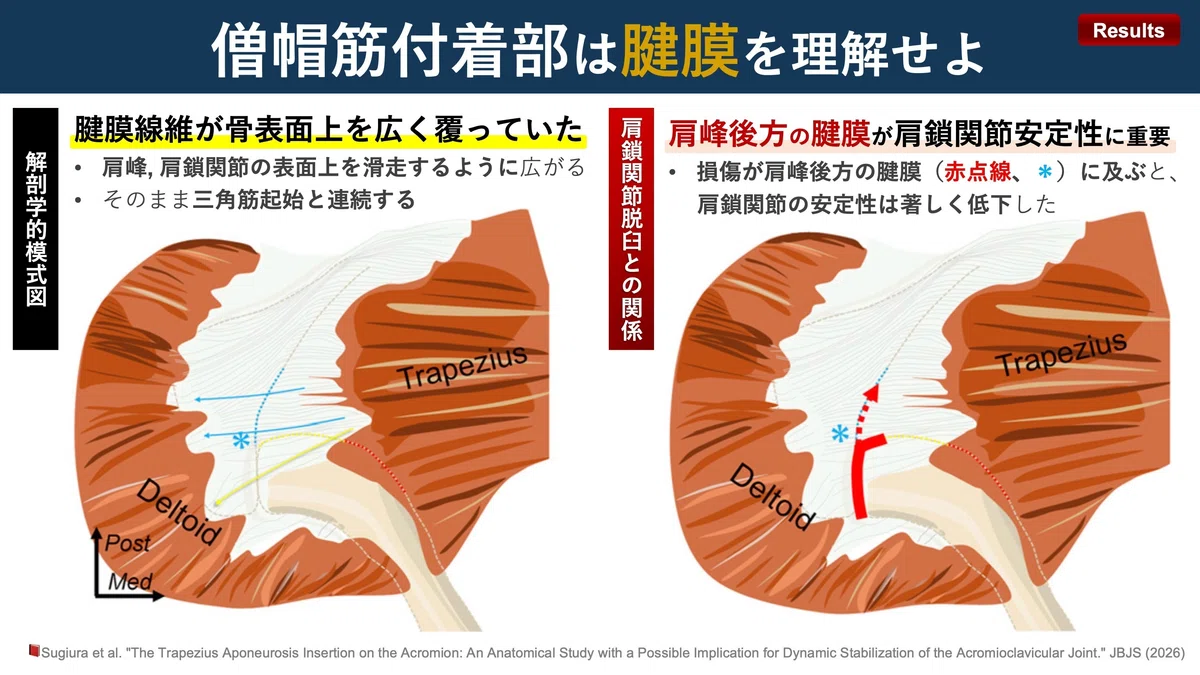 Understand the 'Aponeurosis' at the Trapezius Attachment｜Super Human ...