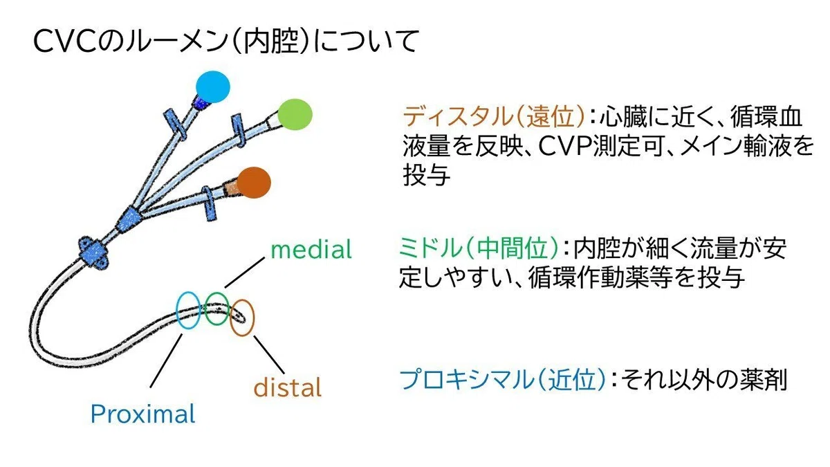 ④看護師に必要な勉強項目＜デバイス・ドレーン＞CVCのdistal,medial,proximalの違い、繋ぐ薬剤の種類について｜看護の学舎