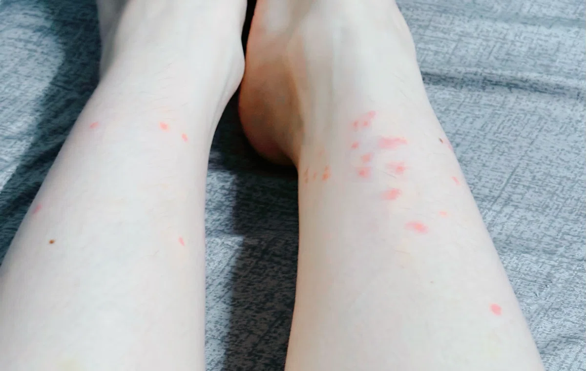 【🇹🇼ワーホリ】ストレスで…止まった😭｜Aine