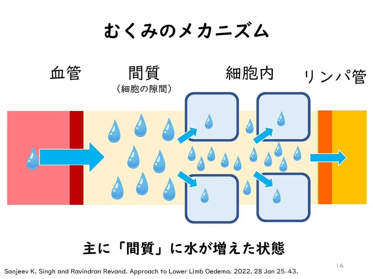 むくみのメカニズムと改善方法｜栄養実践管理士 大久保晶子