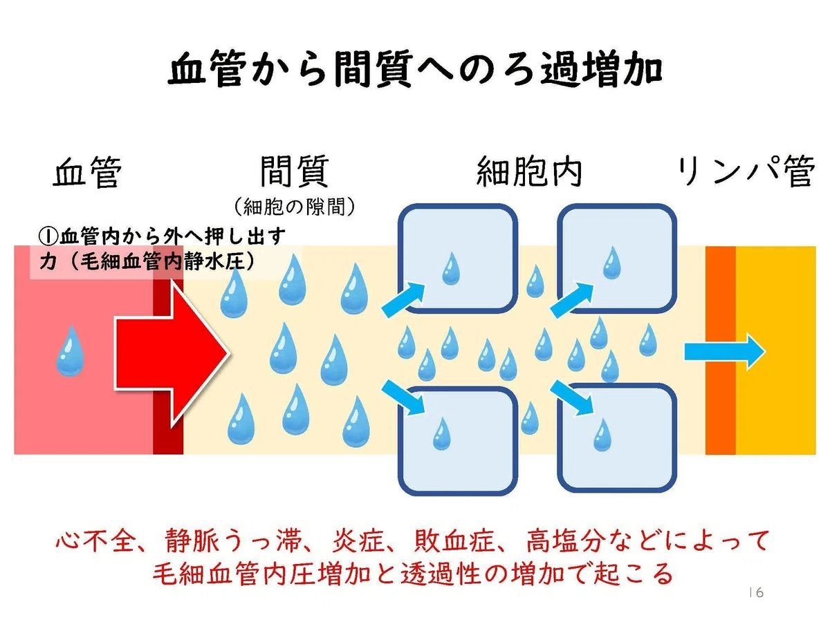 むくみのメカニズムと改善方法｜栄養実践管理士 大久保晶子