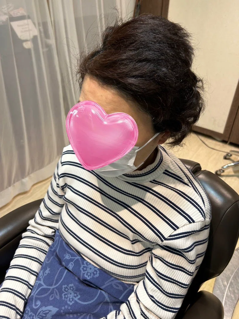 8 months after ditching the wig following chemotherapy. The 8-month ...