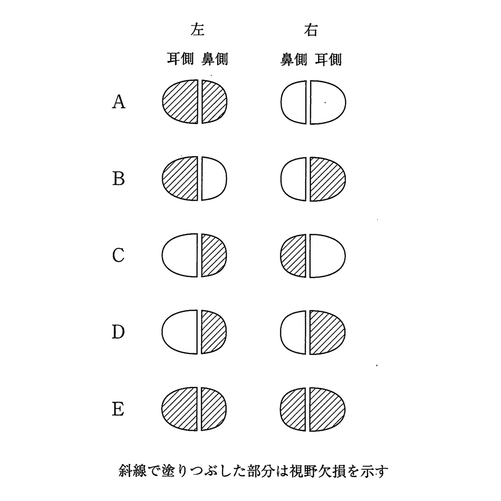 Emergency Life Saving Technician 47th A Problem - 90｜iZONE