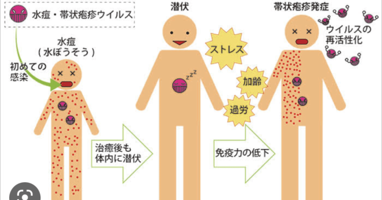 加藤隆太の毎日なぞかけを続けることをやってみた。2427日目のテーマ、そうだ、健康になろう｜加藤隆太（kato ryuta）｜note