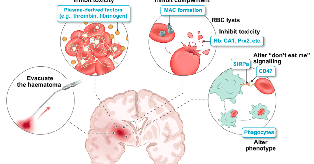 書記が論文読むだけ#1227-Novel targets, treatments, and advanced models for intracerebral haemorrhage ...
