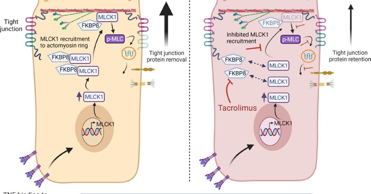 MLCKの仲間を見つける：腸管透過性の治療標的の可能性を高める｜哉百名