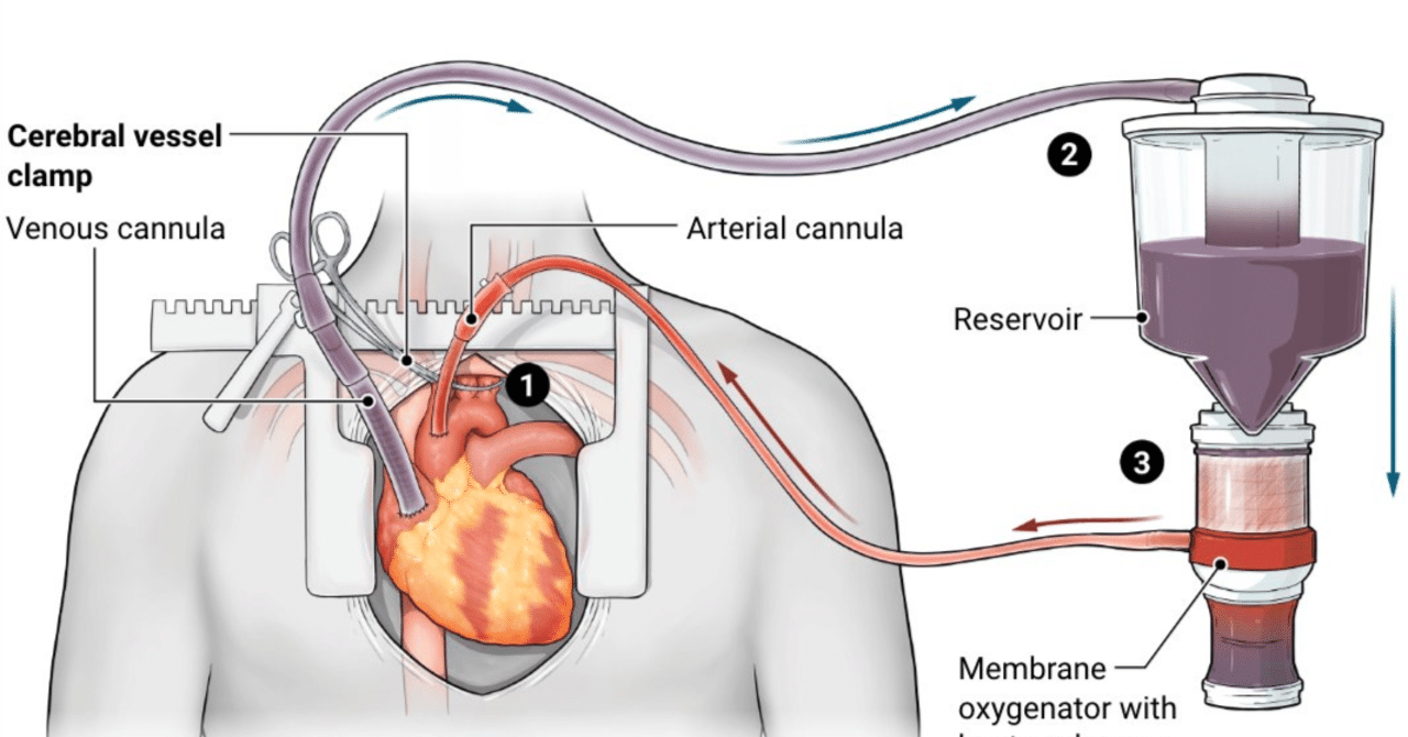 循環的死後の臓器提供 DCD (donation after circulatory death) について｜ebnysk