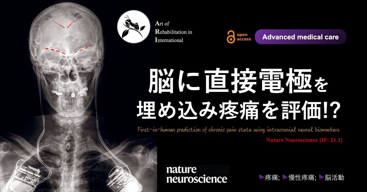 脳に直接電極を埋め込み疼痛を評価|super Human 理学療法士/保健学博士 Phd