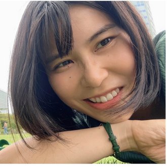 慢性腰痛がある方へ。 貼り薬で対処していませんか？ 貼り薬は一時的な痛みをとることが目的であり、根本治療にはなりません。 あなたの姿勢、歩き方 ...