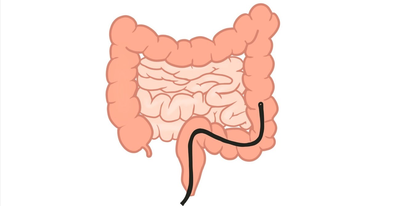COLONOSCOPY #3｜Gentle Gian