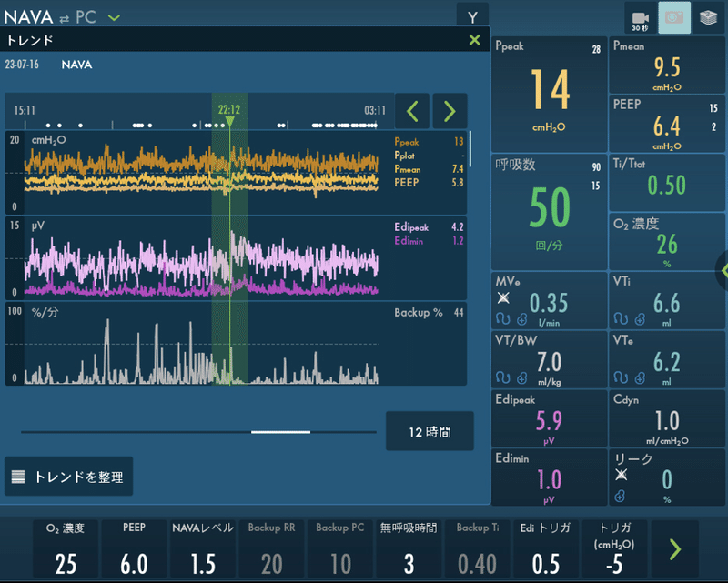 NAVA管理中のちょっとしたコト｜あかちゃんまん