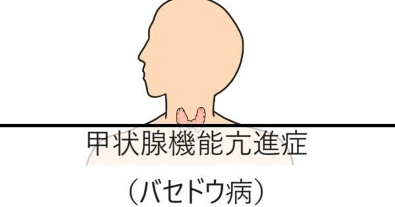 【完全公開はnoteだけ】サクッとまるわかり!甲状腺機能亢進症(バセドウ病)の看護診断|なんでなんだナーシング30 ~看護師・看護学生の