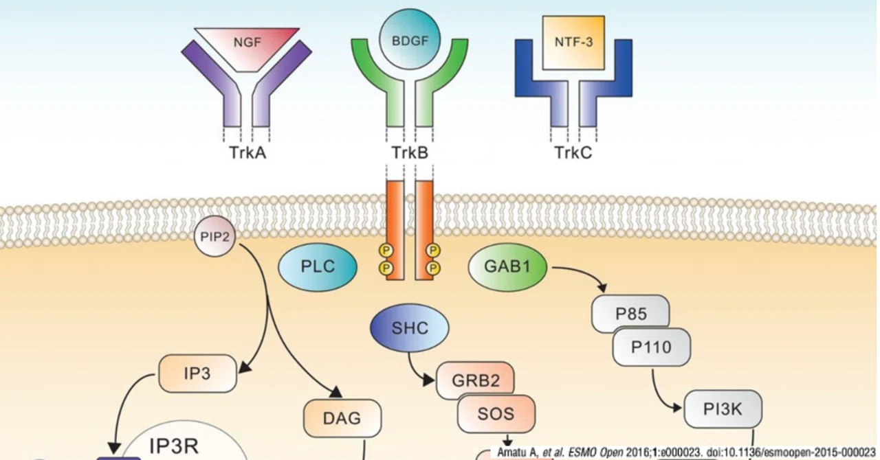 実践：NTRK再構成紡錘形細胞腫瘍 NTRK-rearranged spindle cell neoplasm（いわゆるキナーゼ遺伝子異常を ...