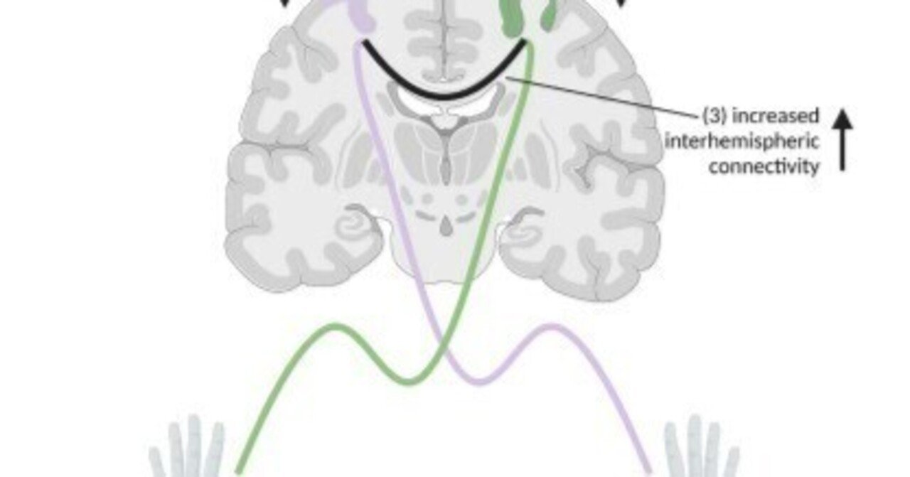片側の運動を反復すると中枢での機能的接続が変化し、対側肢の反応時間が向上する｜Brain storm conditioning 〜 脳からコンディショニング