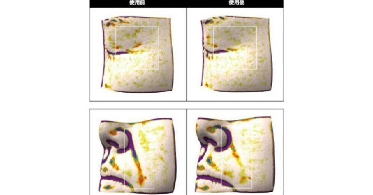 「メディトールド研究所」AACIクリームの効能、人体適用試験で立証する｜NEWS