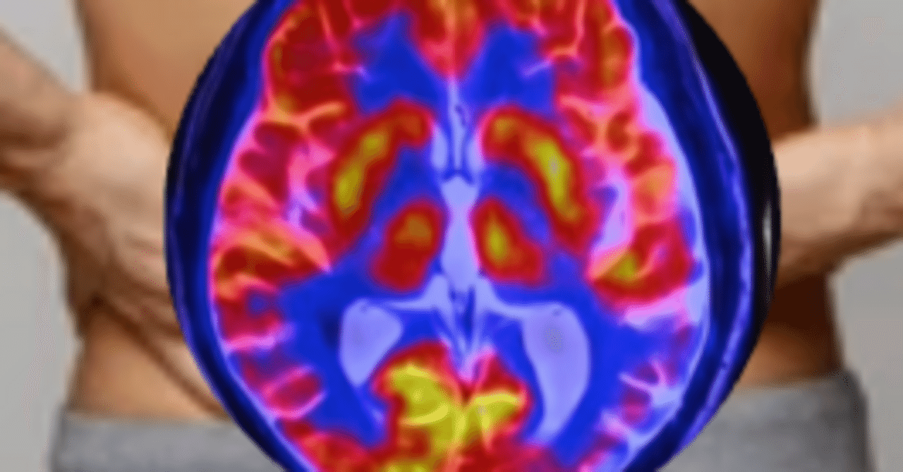 腰痛と神経可塑性｜Brain storm conditioning 〜 脳からコンディショニング