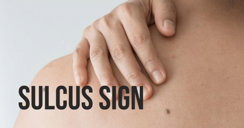 Sulcus Sign：肩関節下方不安定性の有無｜PT Type B