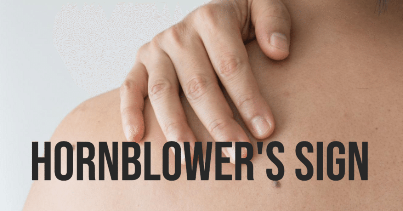 Hornblower's Sign：小円筋の断裂の有無｜PT Type B