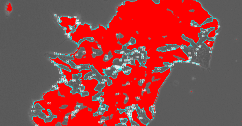 【imageJ】指定範囲内の蛍光面積を測定したい｜ぶるーく
